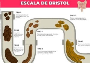 Escala de Bristol: Um guia completo para monitorar sua saúde